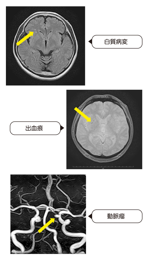 脳MRI検査の有効性 | 健康コラム | フェニックスメディカルクリニック